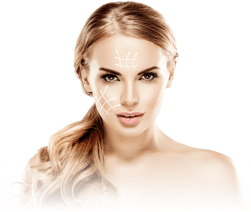 Thread Lift Clinic in Toronto & Mississauga | Thread Lift Doctor